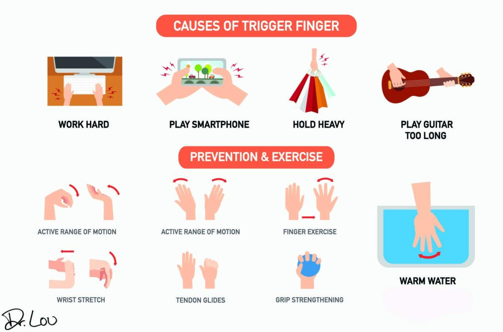 Trigger finger infographic,vector illustration - Jacobs Chiropractic ...