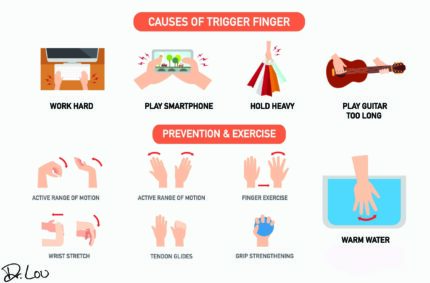 Trigger finger infographic,vector illustration - Jacobs Chiropractic ...