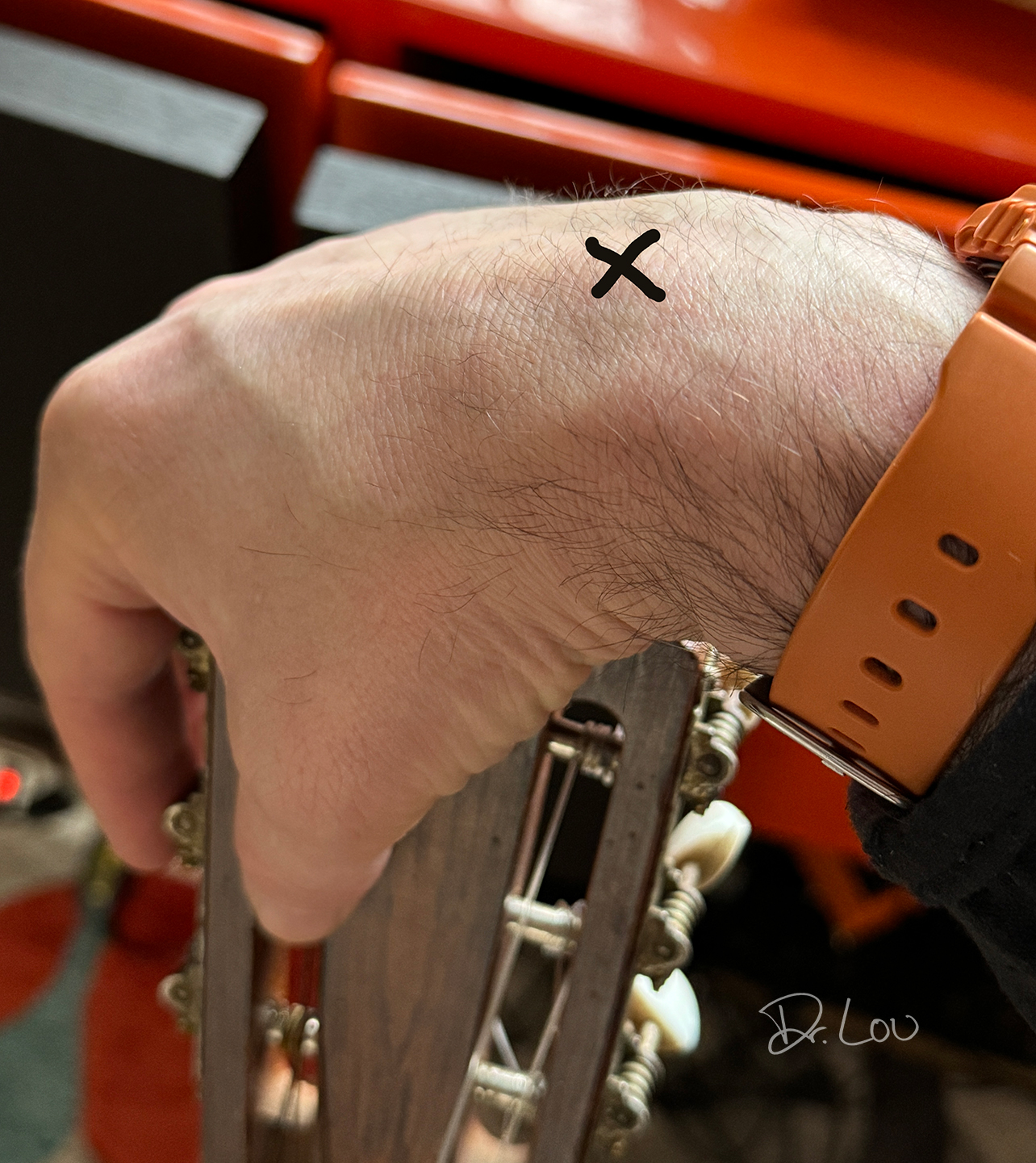 Carpal Boss and the guitar player. Expert advice - Jacobs Chiropractic ...